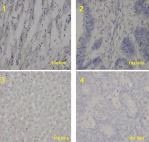 How-Does-Poly-HRP-Secondary-Antibody-Amplify-Signal? - FineTest Antibody