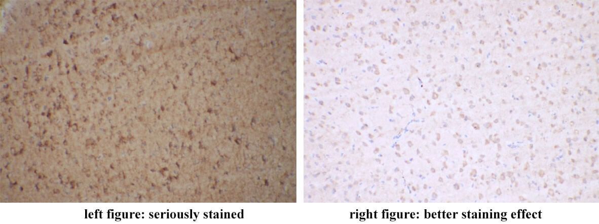 Immunohistochemistry Background Staining Analysis - FineTest Antibody