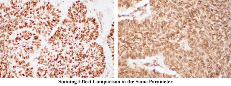 Immunohistochemistry Background Staining Analysis - FineTest Antibody