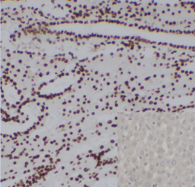 Poly HRP-conjugated Affinipure Goat Anti-Mouse/Rabbit IgG (H+L ...