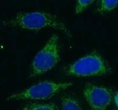 Giantin antibody - FineTest ELISA Kit | FineTest Antibody | Wuhan Fine ...