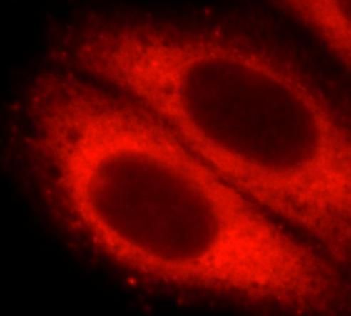 Syntaxin 12 Antibodies | AntibodyResource.com