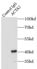 ACTA2/smooth muscle actin antibody - FineTest ELISA Kit | FineTest ...