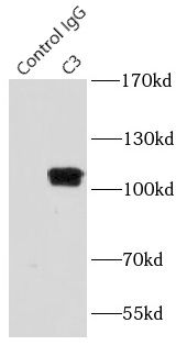 C3 / C3b / C3c antibody - FineTest ELISA Kit | FineTest Antibody ...