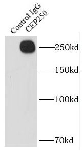 CEP250 antibody - FineTest ELISA Kit | FineTest Antibody | Wuhan Fine ...