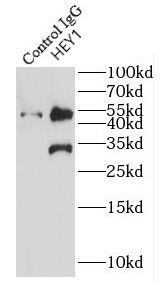 HEY1 antibody - FineTest ELISA Kit | FineTest Antibody | Wuhan Fine ...