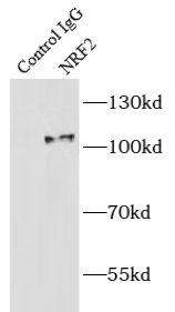 NRF2, NFE2L2 antibody - FineTest ELISA Kit | FineTest Antibody | Wuhan ...