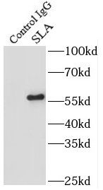 Sep (O-Phosphoserine) TRNA:Sec (Selenocysteine) TRNA Synthase ...