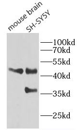 PHD2 antibody - FineTest ELISA Kit | FineTest Antibody | Wuhan Fine ...